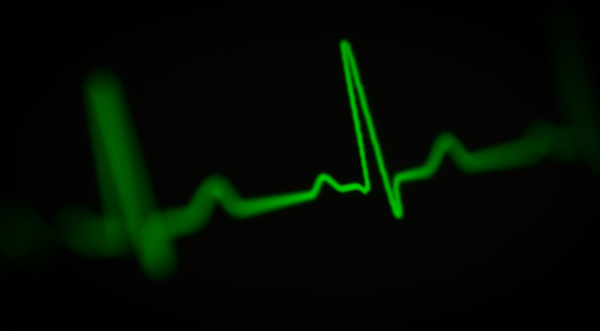 Pulso: Medición, Signos Vitales y Frecuencia Cardíaca